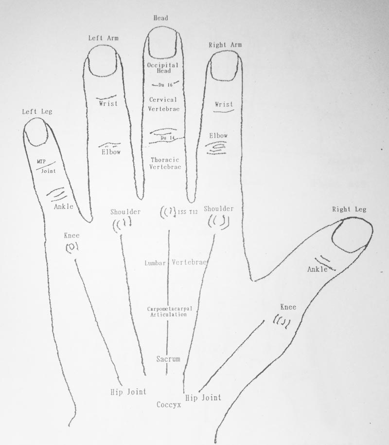 Korean Hand Acupuncture